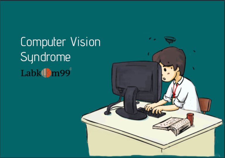 Computer Vision Syndrome Beserta Penyebabnya